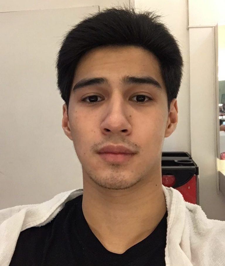 Albie Casino - Biography Profiles